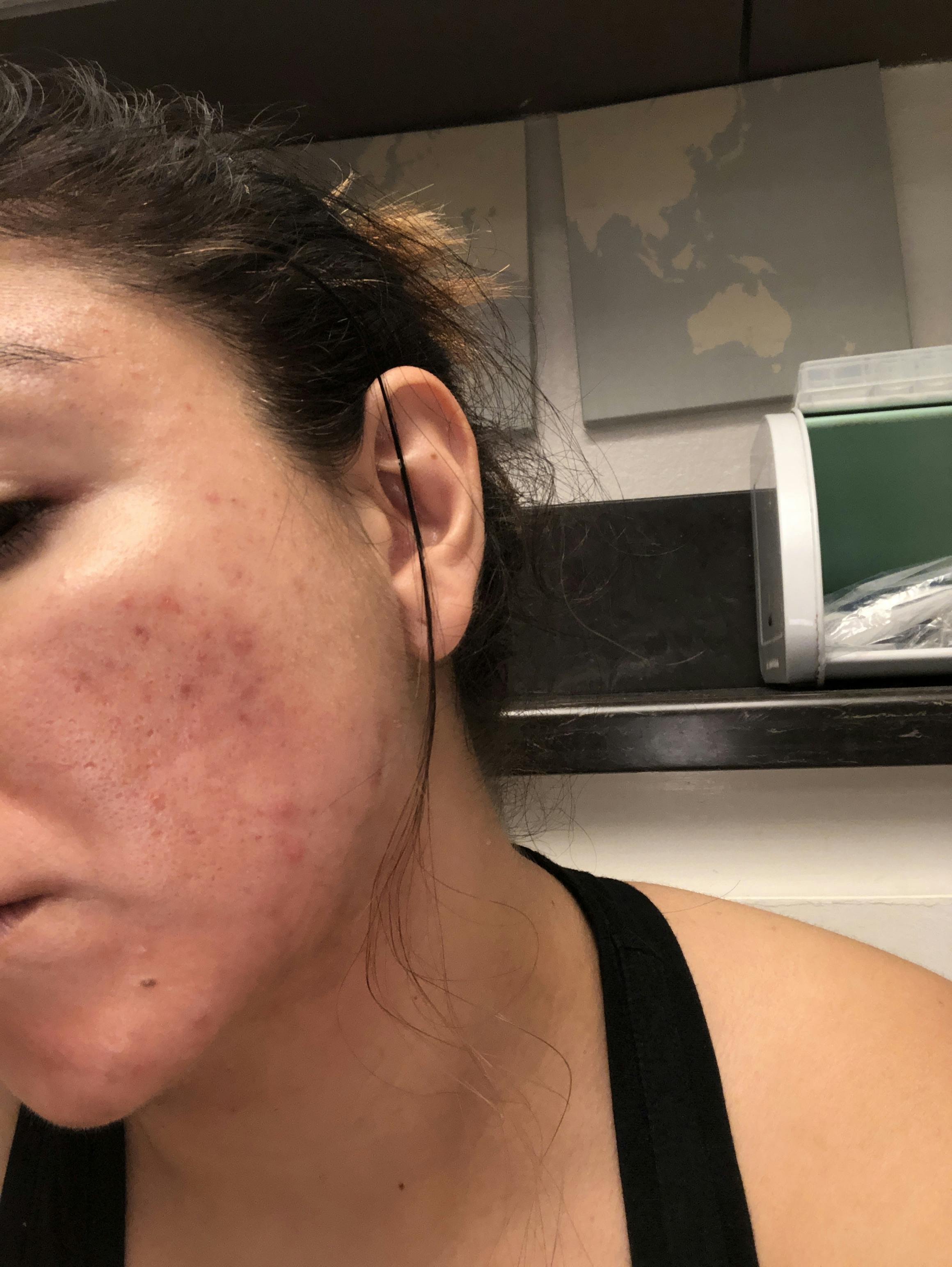 Eye Bright Now – The Better Skin Co.