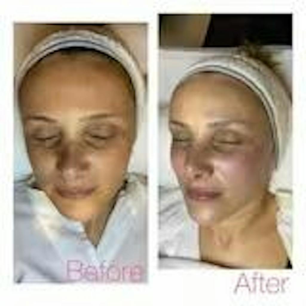 Cleopatra Led Light Mask™ – The Cleopatra Mask