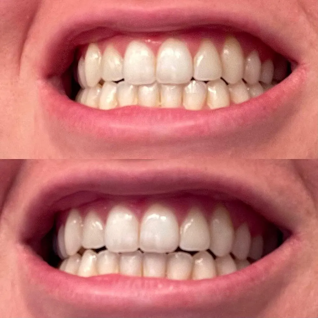 The White Smiles