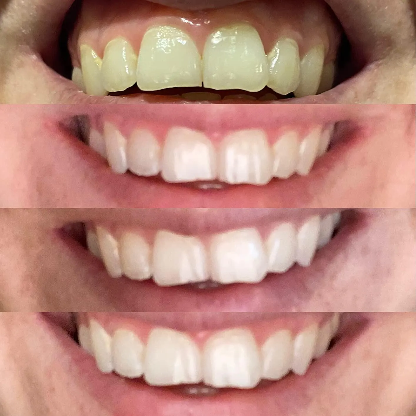 The White Smiles