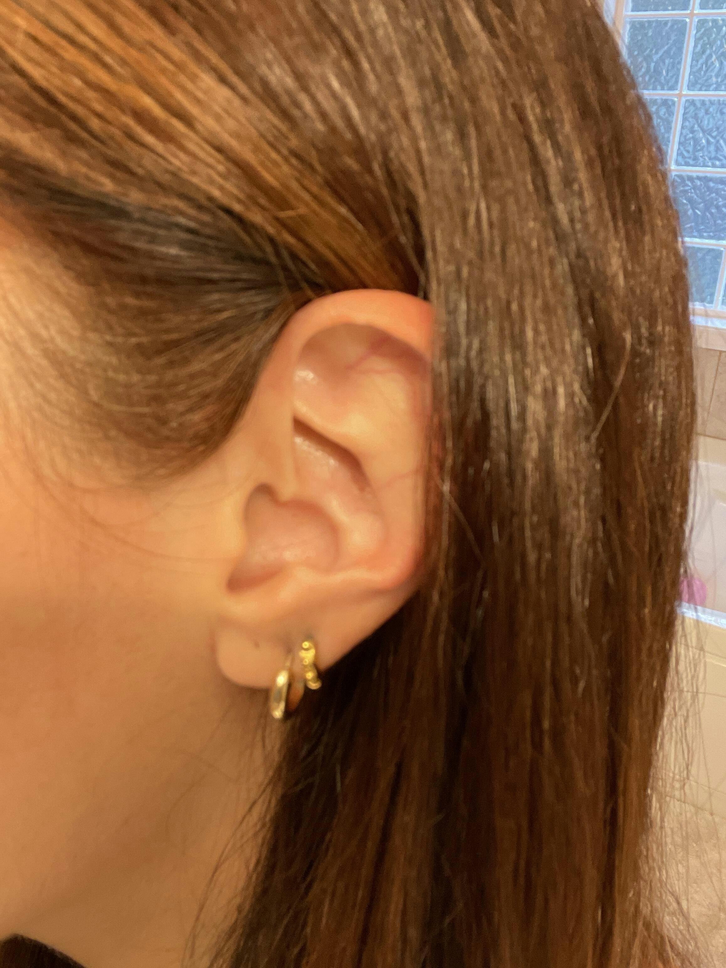 Tini Lux Hypoallergenic Titanium Single Beaded Cartilage Huggie ...