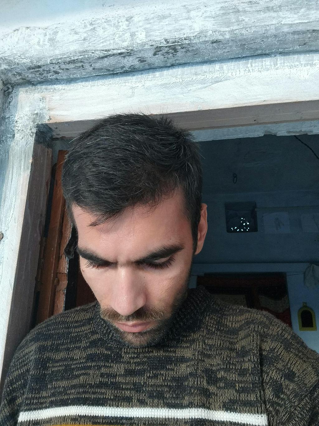 Traya hair review | Traya review | Traya Health