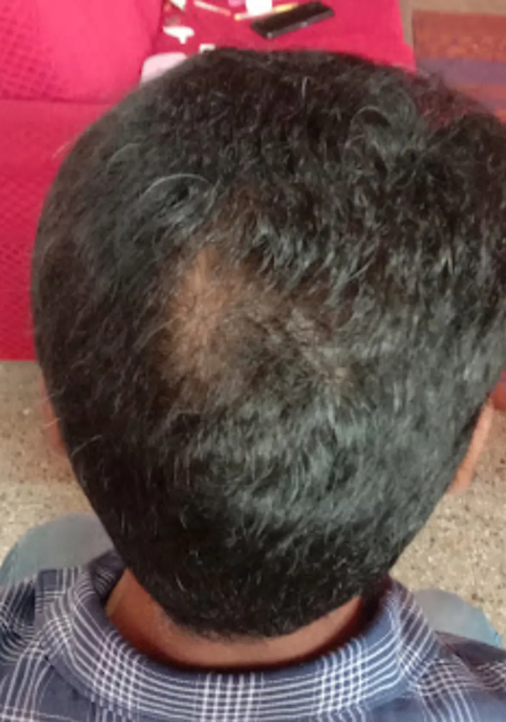 Traya Hair Reviews | Real Hair Growth Stories & Testimonials