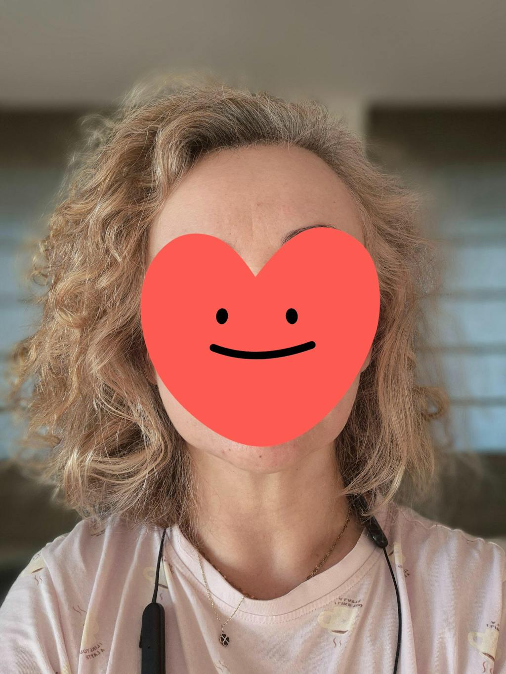 Real TYMO Reviews | See Stunning Hair Transformations and Results