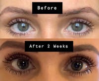 Uklash Eyelash Growth Serum for Longer, Fuller and Healthier Lashes ...