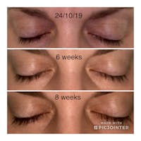 Uklash Eyelash Growth Serum for Longer, Fuller and Healthier Lashes ...
