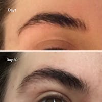 Uklash Eyelash Growth Serum for Longer, Fuller and Healthier Lashes ...