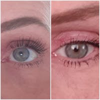 Uklash Eyelash Enhancer Serum for longer, fuller and healthier lashes ...