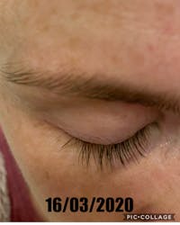 Uklash Eyelash Growth Serum for Longer, Fuller and Healthier Lashes ...