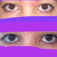 Uklash Eyelash Growth Serum for Longer, Fuller and Healthier Lashes ...