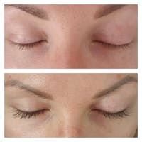 Uklash Eyelash Growth Serum for Longer, Fuller and Healthier Lashes ...