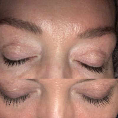 Uklash Eyelash Enhancer Serum for longer, fuller and healthier lashes ...