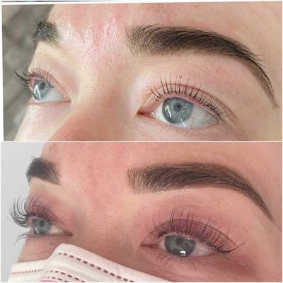 Uklash Eyelash Growth Serum for Longer, Fuller and Healthier Lashes ...