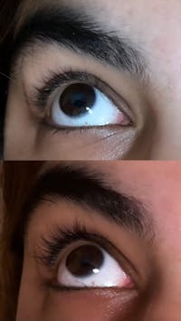 Before & After Photos – UKLASH
