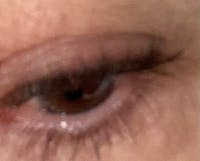 Before & After Photos – UKLASH