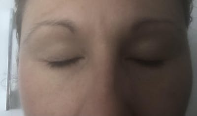 Before & After Photos – UKLASH