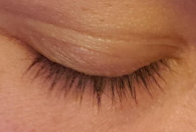 Before & After Photos – UKLASH