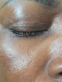 Before & After Photos – UKLASH