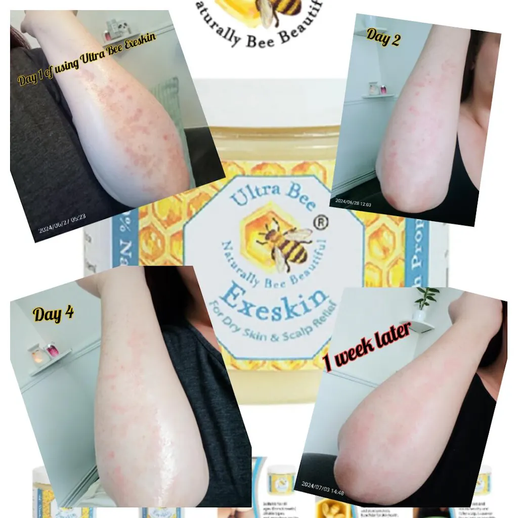 Ultra Bee Health Natural Propolis Skincare
