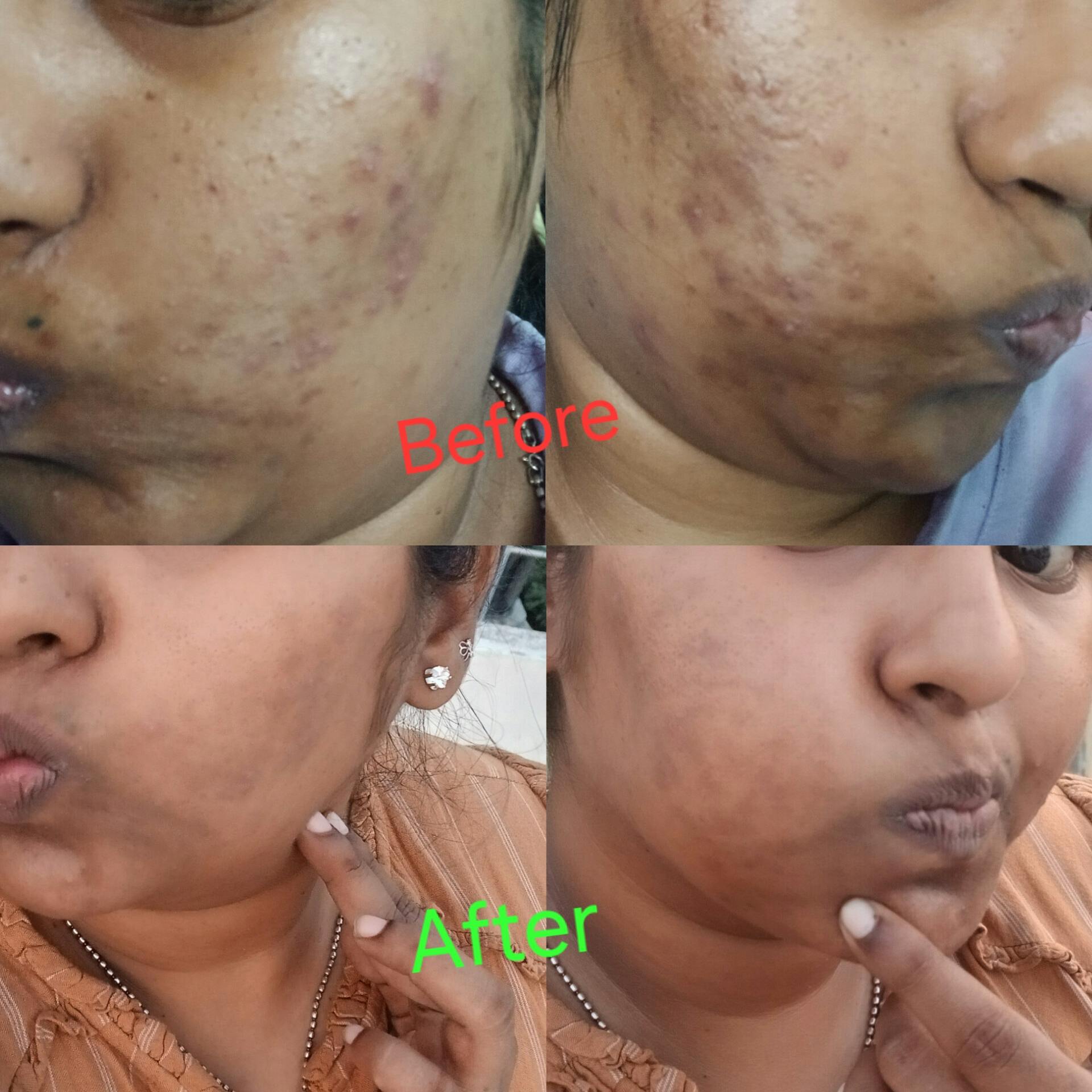 Upto 35% off - Buy Milk Drops Face Brightening Serum Online for Dull ...