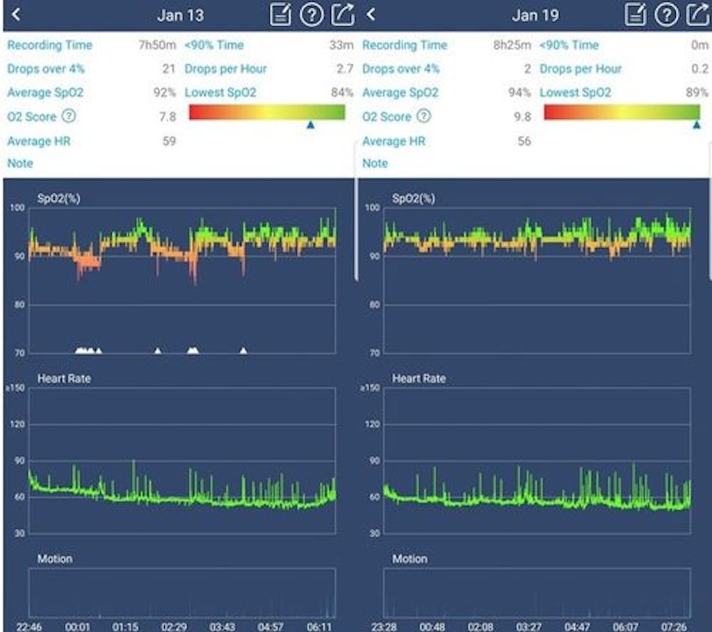O2Ring Sleep Apnea Monitor | Overnight Oxygen Monitor – Wellue