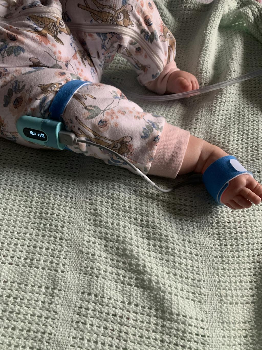 Wearable Smart Sock Baby Sleep Monitor Tracks Infant's O2 Level, Heart ...