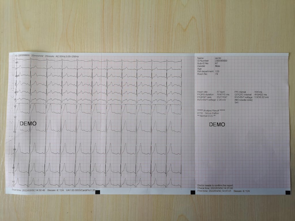 Biocare Digital 12-Lead EKG/ECG Machine with Automatic Interpretation ...