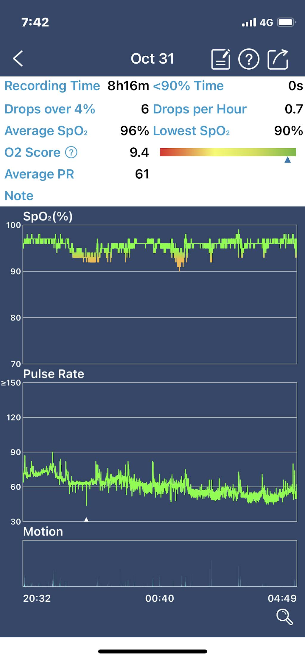 Wellue O2Ring Oxygen Monitor. Continuously Track Overnight Oxygen ...