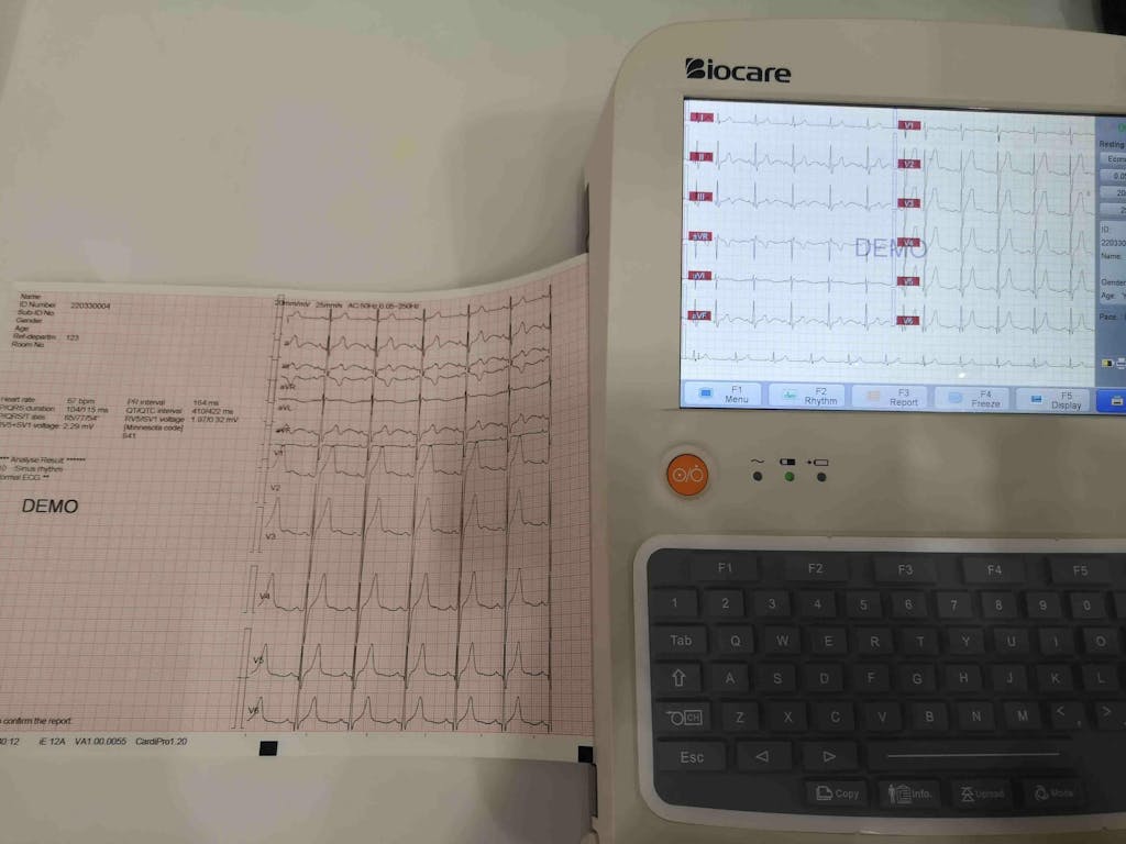 Biocare Digital 12-Lead EKG/ECG Machine with Automatic Interpretation ...