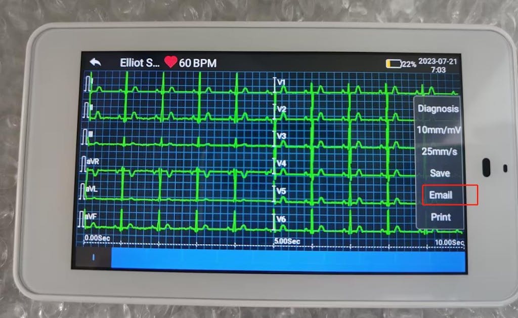 Mobile 6/12-Lead EKG/ECG Machine Fits into Your Pocket, with Auto ...