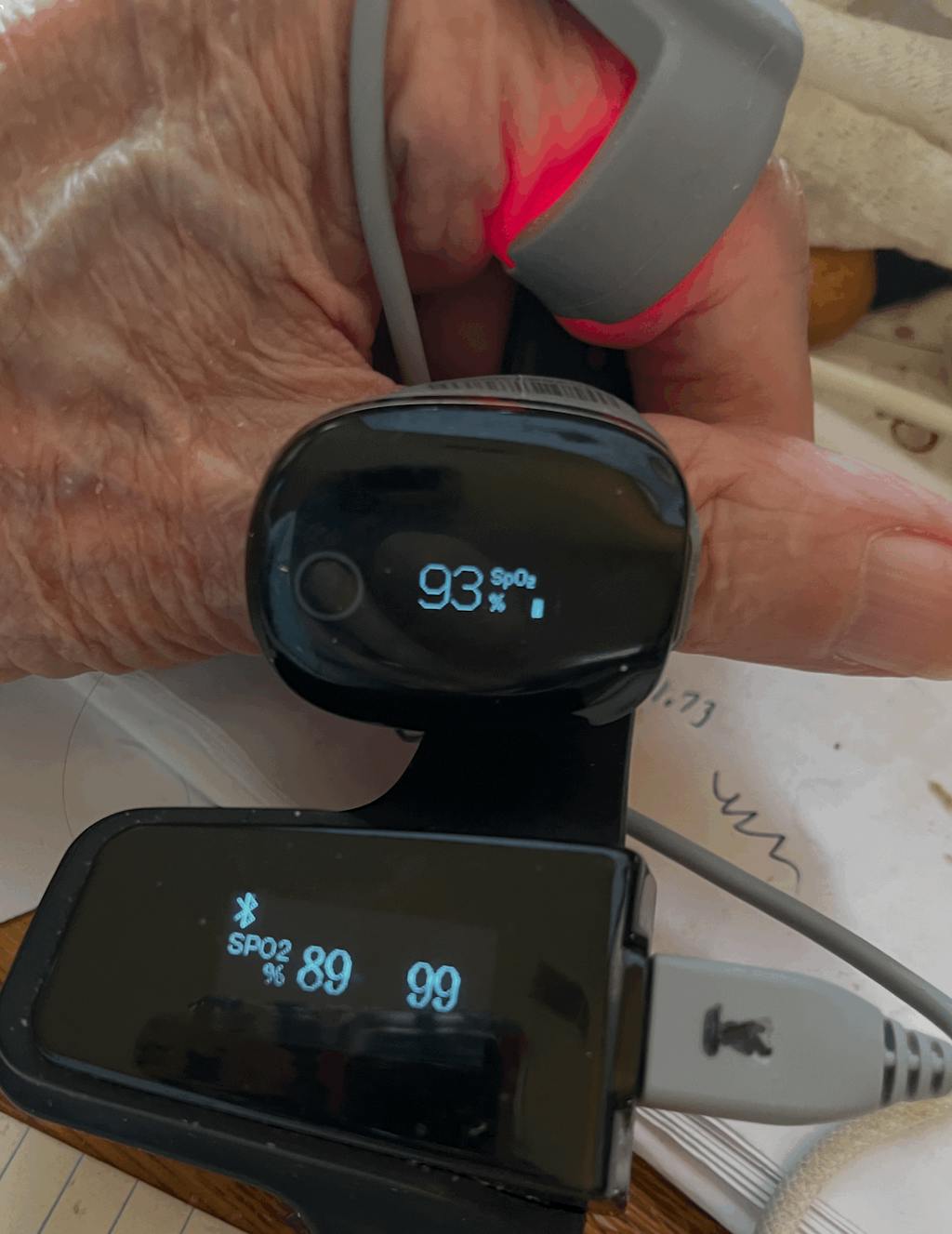 Wellue O2Ring S™ | Upgraded Pulse Oximeter Ring with 24h Oxygen tracking