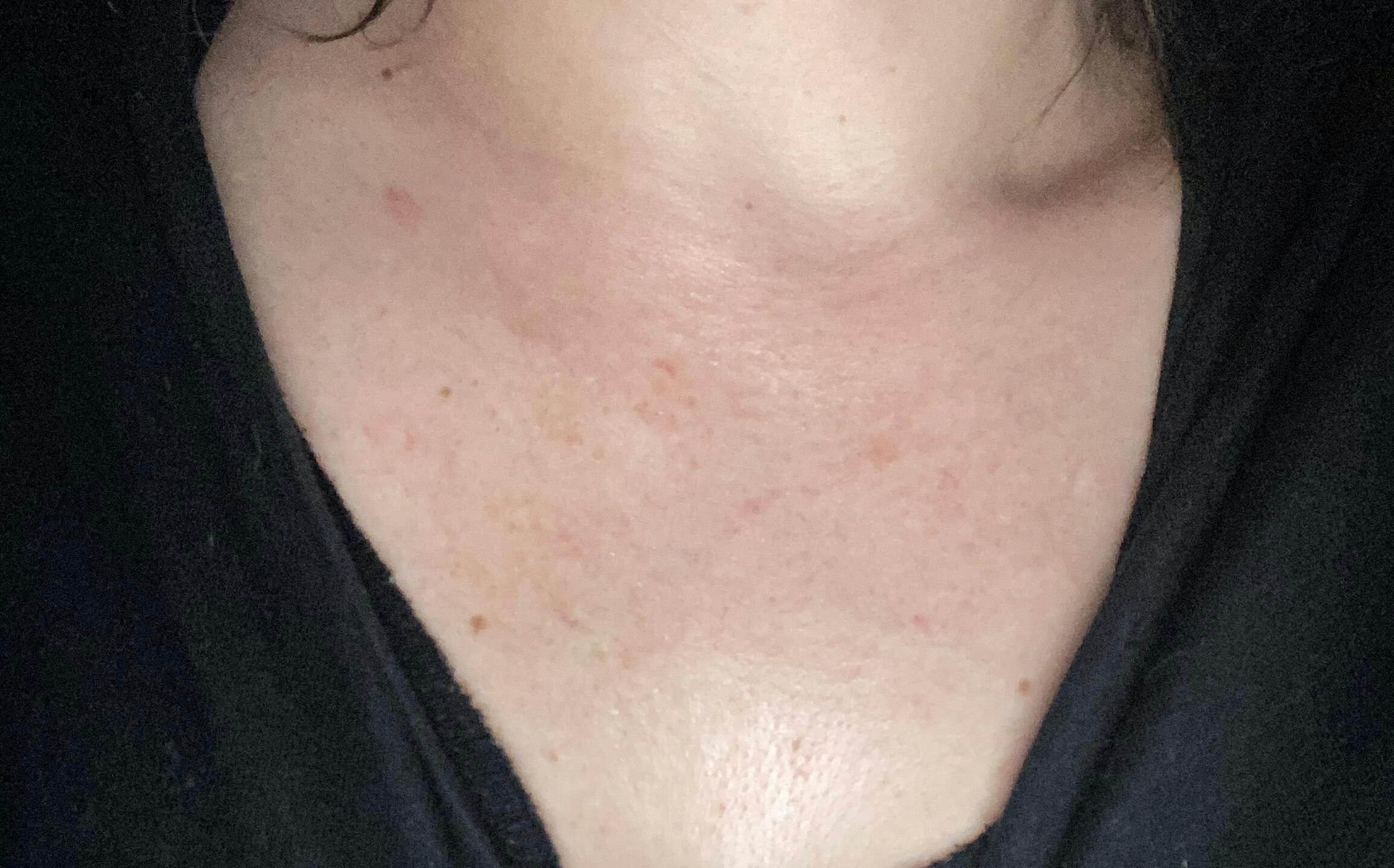 Green Cream | Vegan Skincare Cream – Zoe Bee Beauty