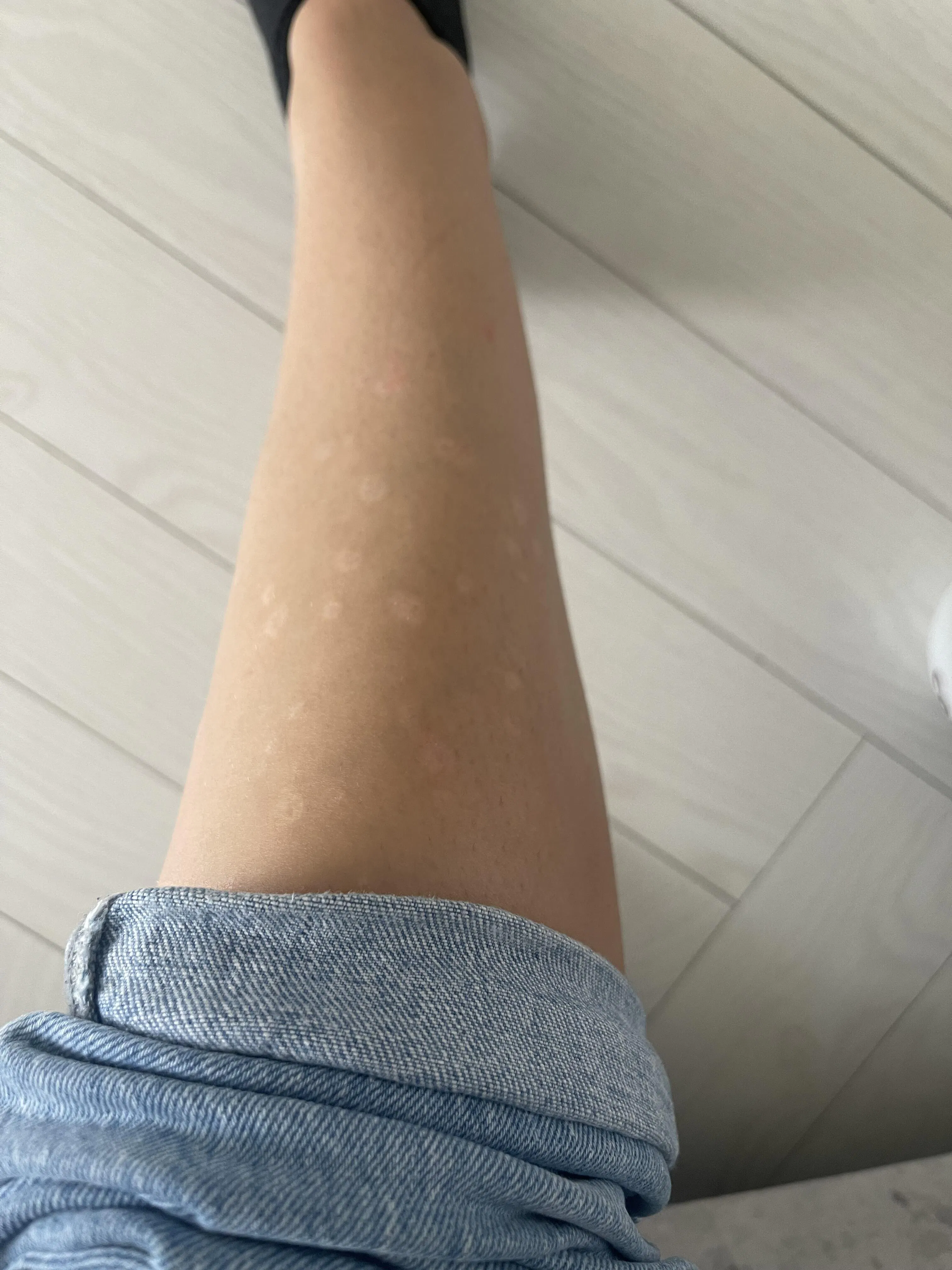 Green Cream | Vegan Skincare Cream – Zoe Bee Beauty