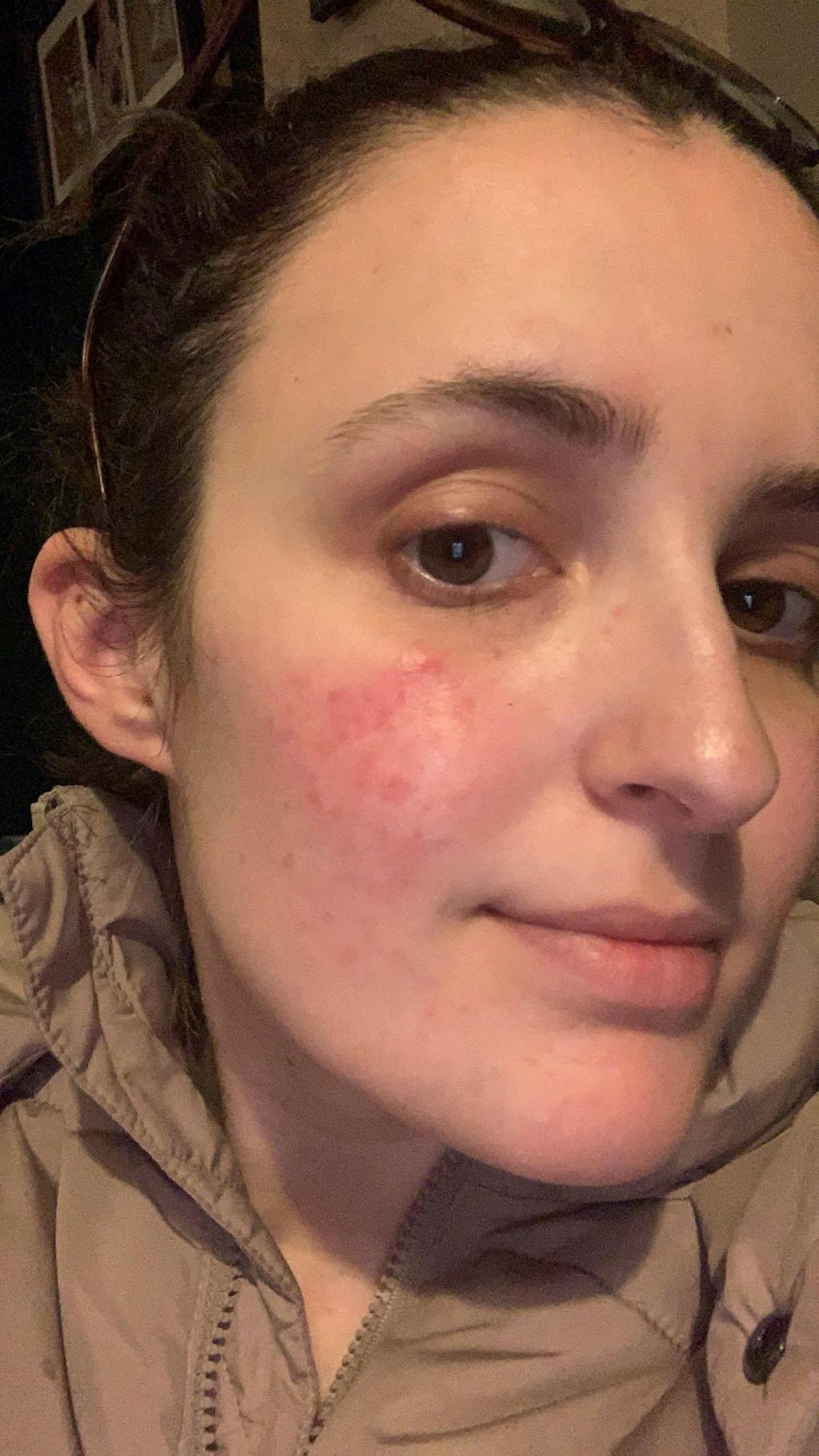 Green Cream | Vegan Skincare Cream – Zoe Bee Beauty