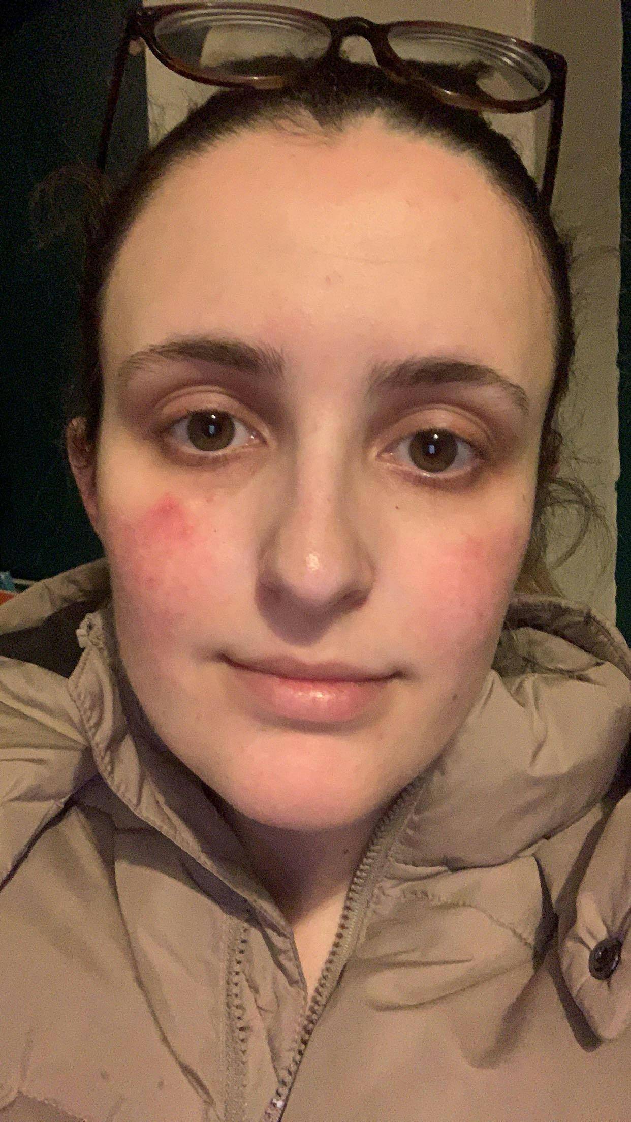 Green Cream | Vegan Skincare Cream – Zoe Bee Beauty