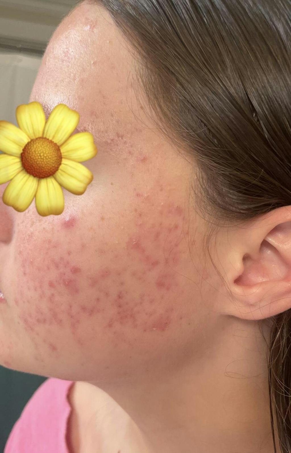 Green Cream | Vegan Skincare Cream – Zoe Bee Beauty